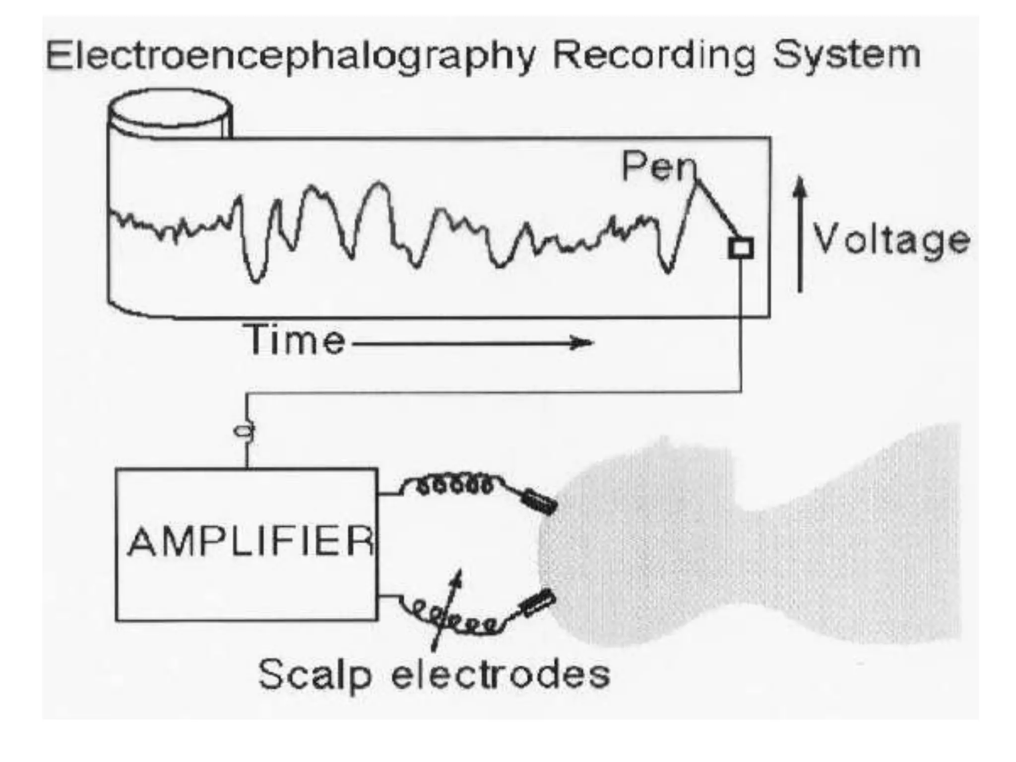 EEG INTERPRETATION | PPTX