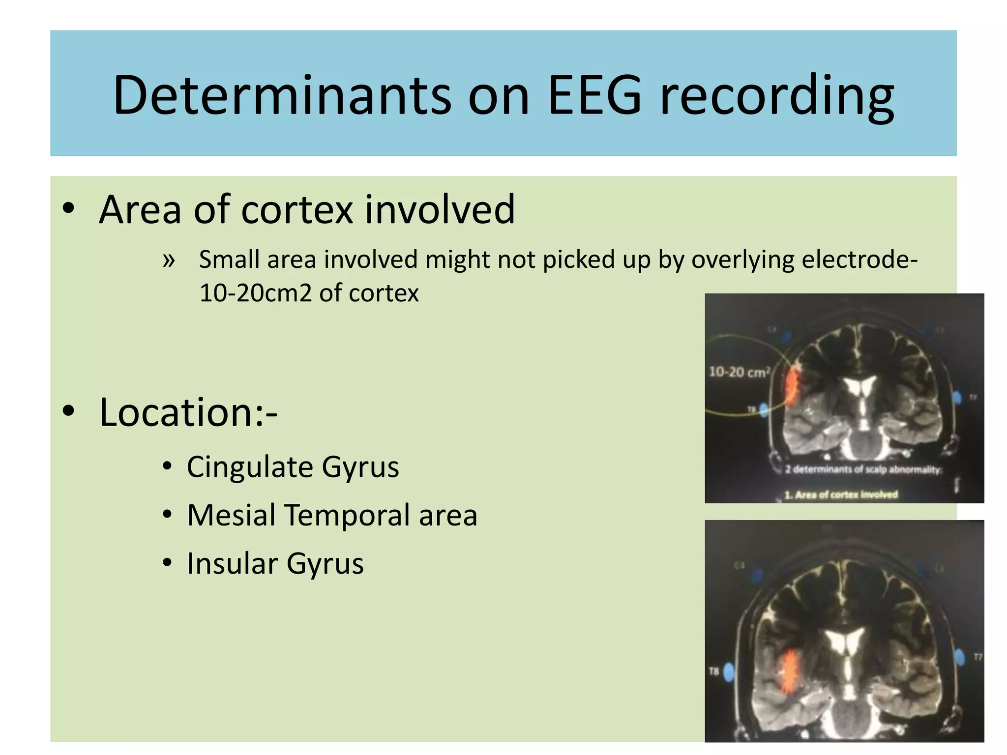 EEG INTERPRETATION | PPTX