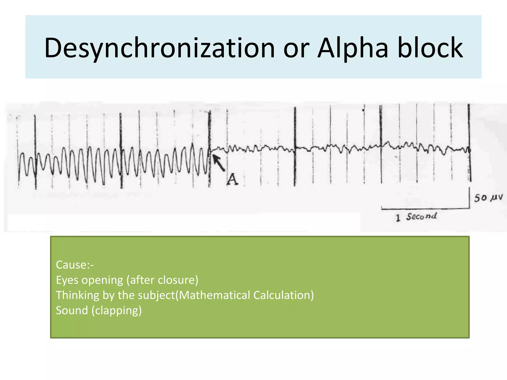 EEG INTERPRETATION | PPTX