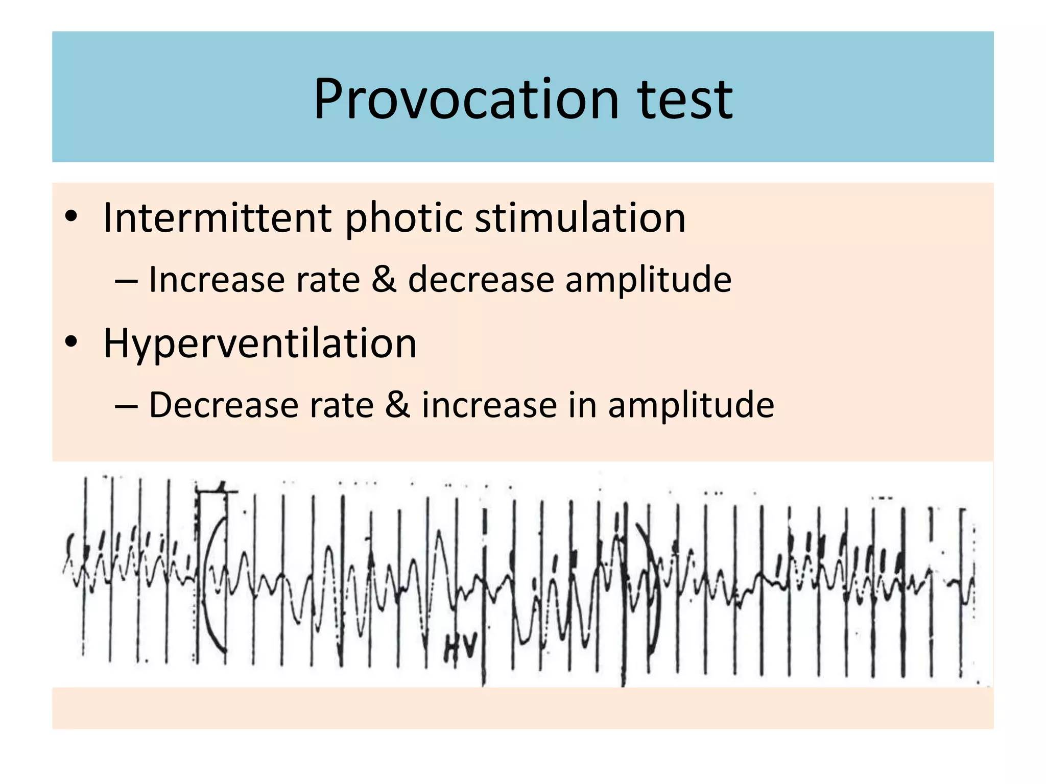 EEG INTERPRETATION | PPTX