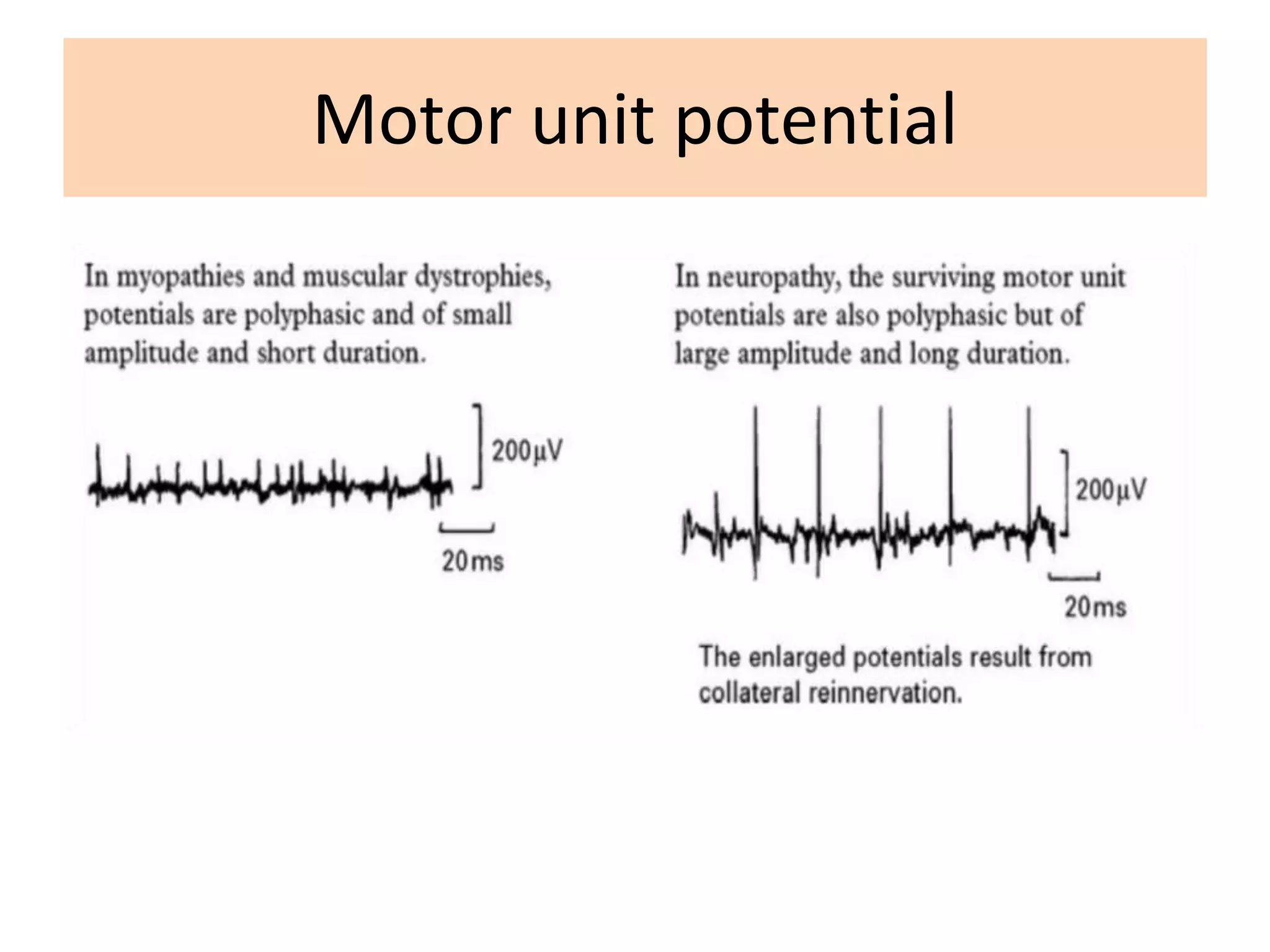 EEG INTERPRETATION | PPTX