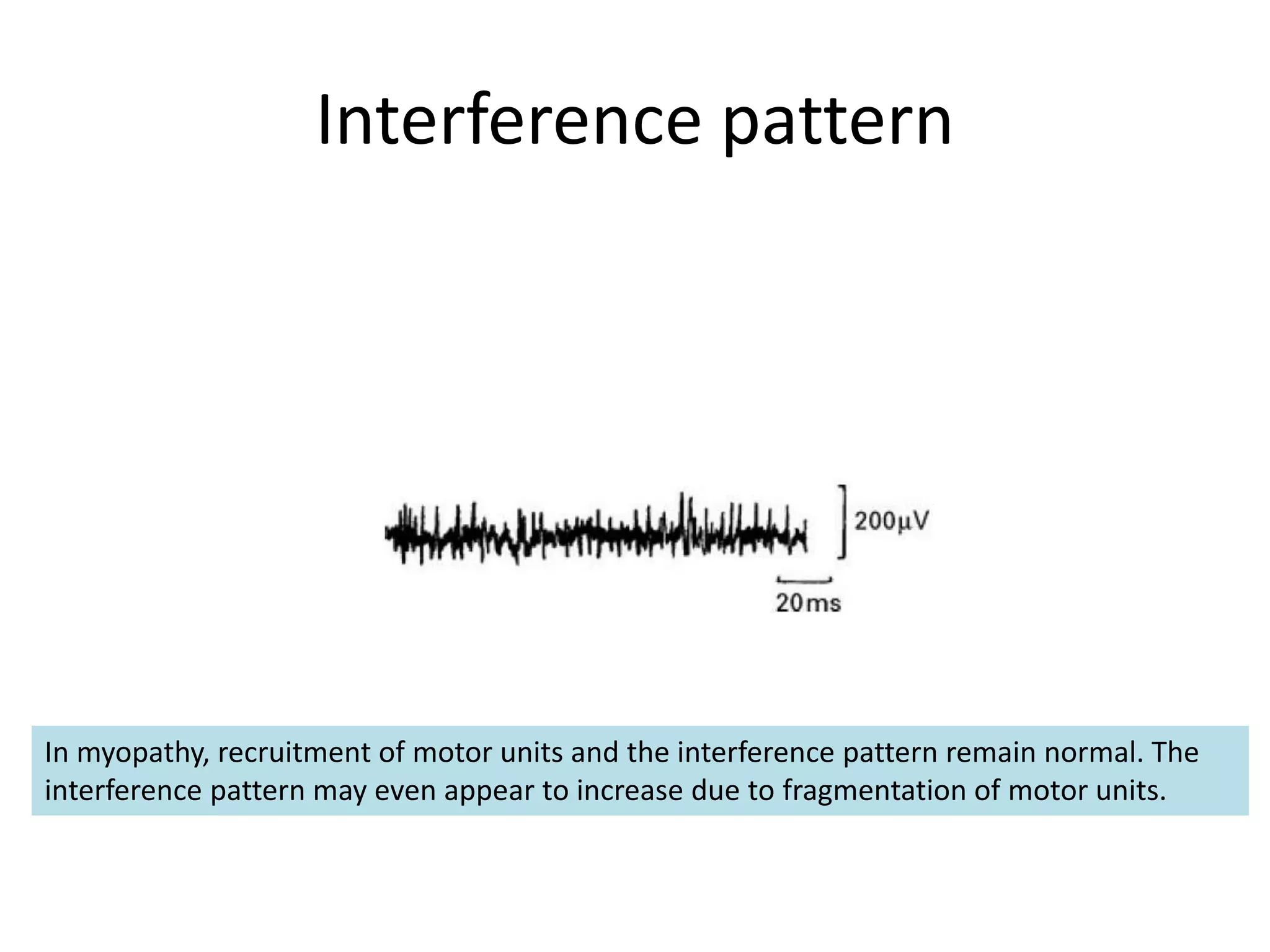 EEG INTERPRETATION | PPTX