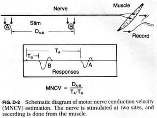 EEG INTERPRETATION | PPTX