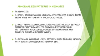 EVOLUTIONARY CHANGES OF EEG DURING INFANCY & ABNORMAL EEG PATTERNS IN ...