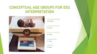 EVOLUTIONARY CHANGES OF EEG DURING INFANCY & ABNORMAL EEG PATTERNS IN ...