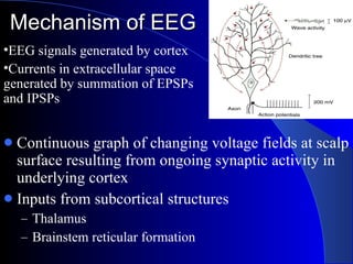 Eeg normal inglish | PPT