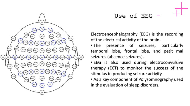 eeg of newborn.pptx