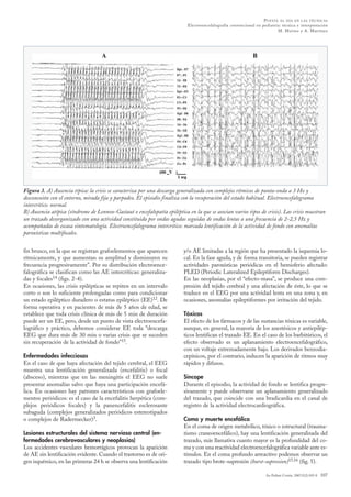 EEG PEDIATRIA IMPRIMIR CONVENCIONAL TECNIA E INTERPRETACION | PDF