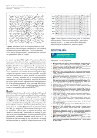 EEG PEDIATRIA IMPRIMIR CONVENCIONAL TECNIA E INTERPRETACION | PDF