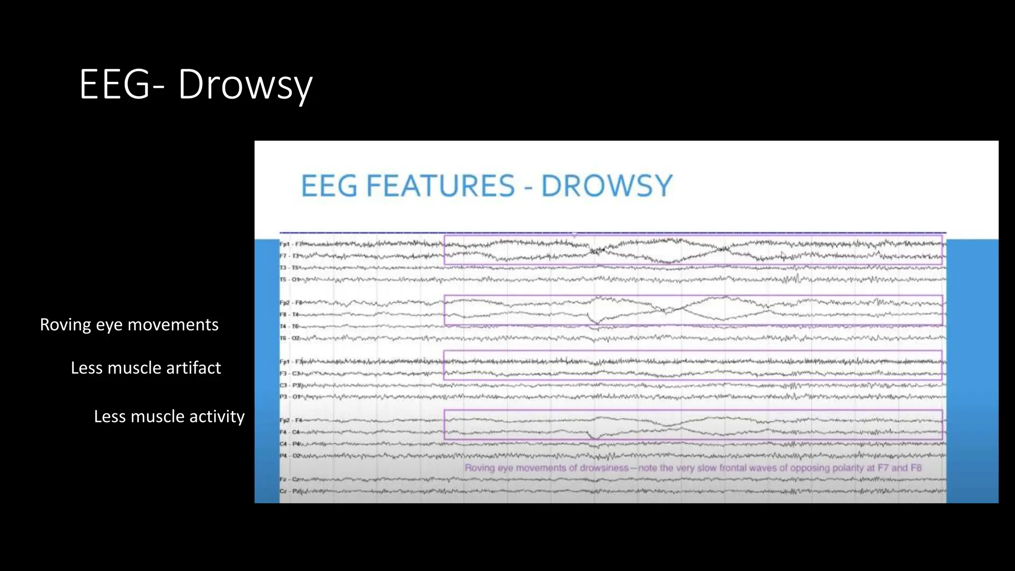 EEG- CONCEPTS AND CLINICAL USES FOR NEUROLOGY RESIDENTS | PPTX