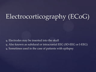 EEG Presentation Kassing/Konold | PPTX