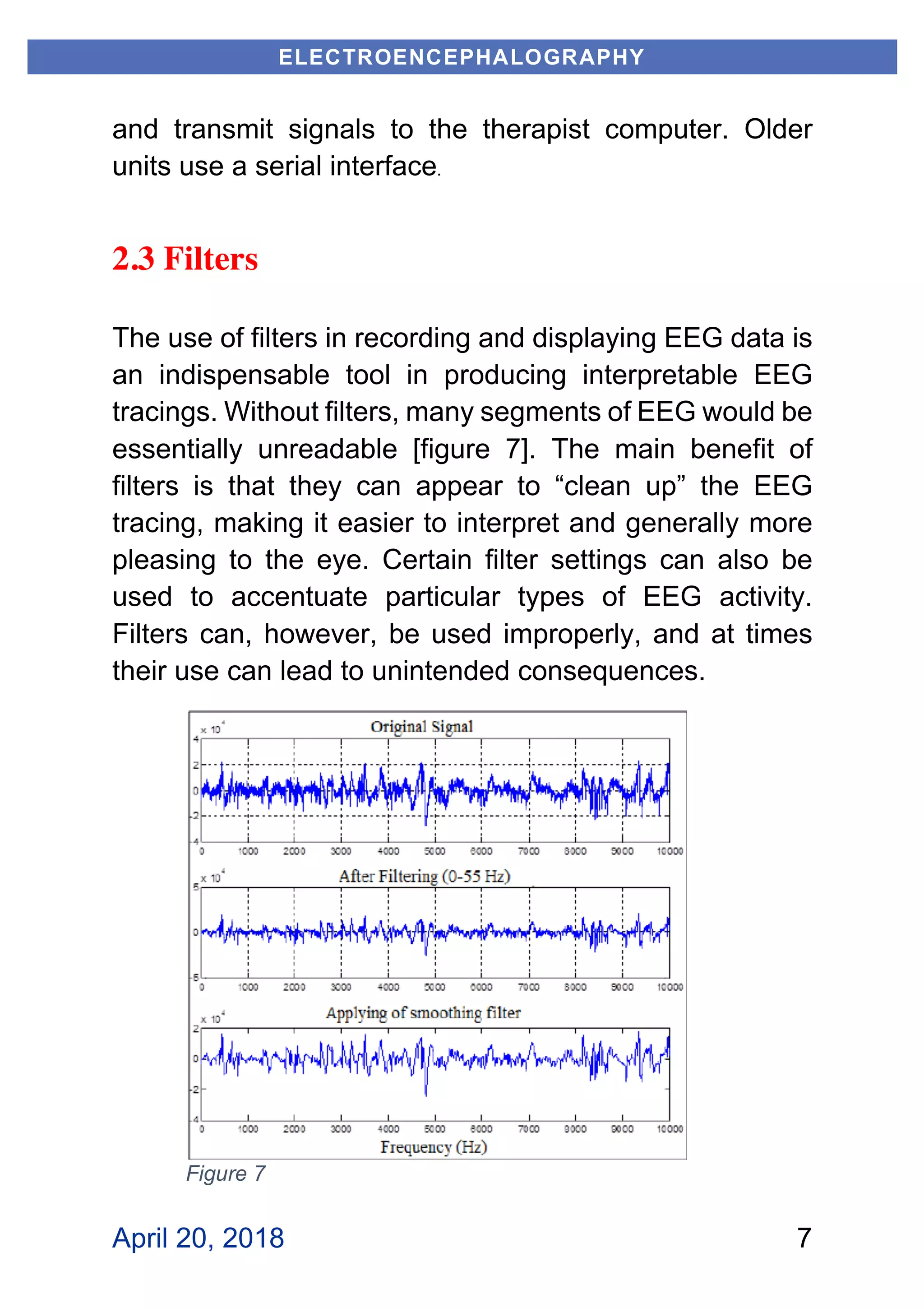 Electroencephalogram (EEG) | PDF
