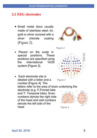 Electroencephalogram (EEG) | PDF