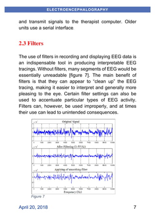 Electroencephalogram (EEG) | PDF