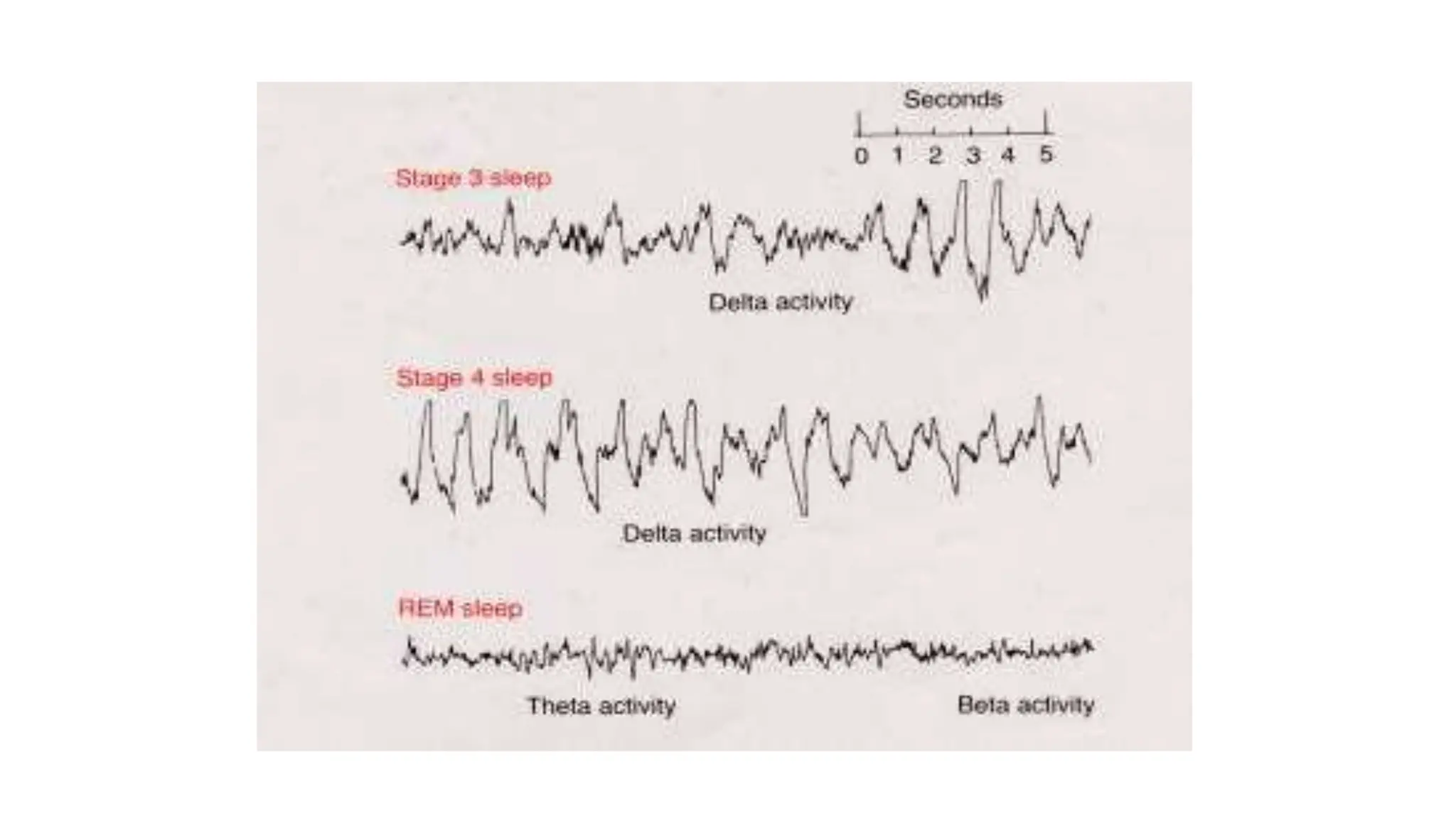 eeg ppt defining all aspects of eeg and various type of waves seen in ...