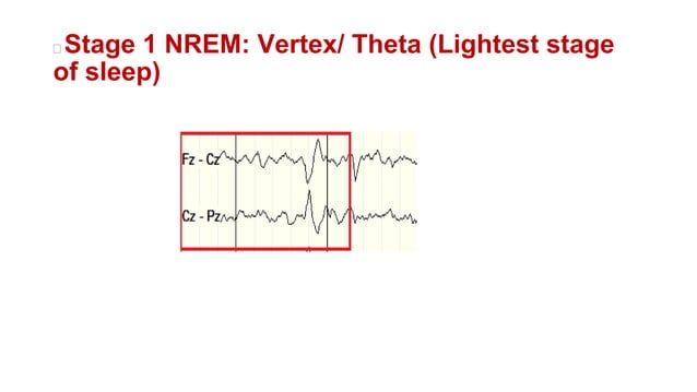 eeg ppt defining all aspects of eeg and various type of waves seen in ...
