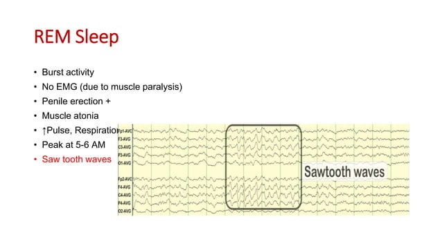 eeg ppt defining all aspects of eeg and various type of waves seen in ...