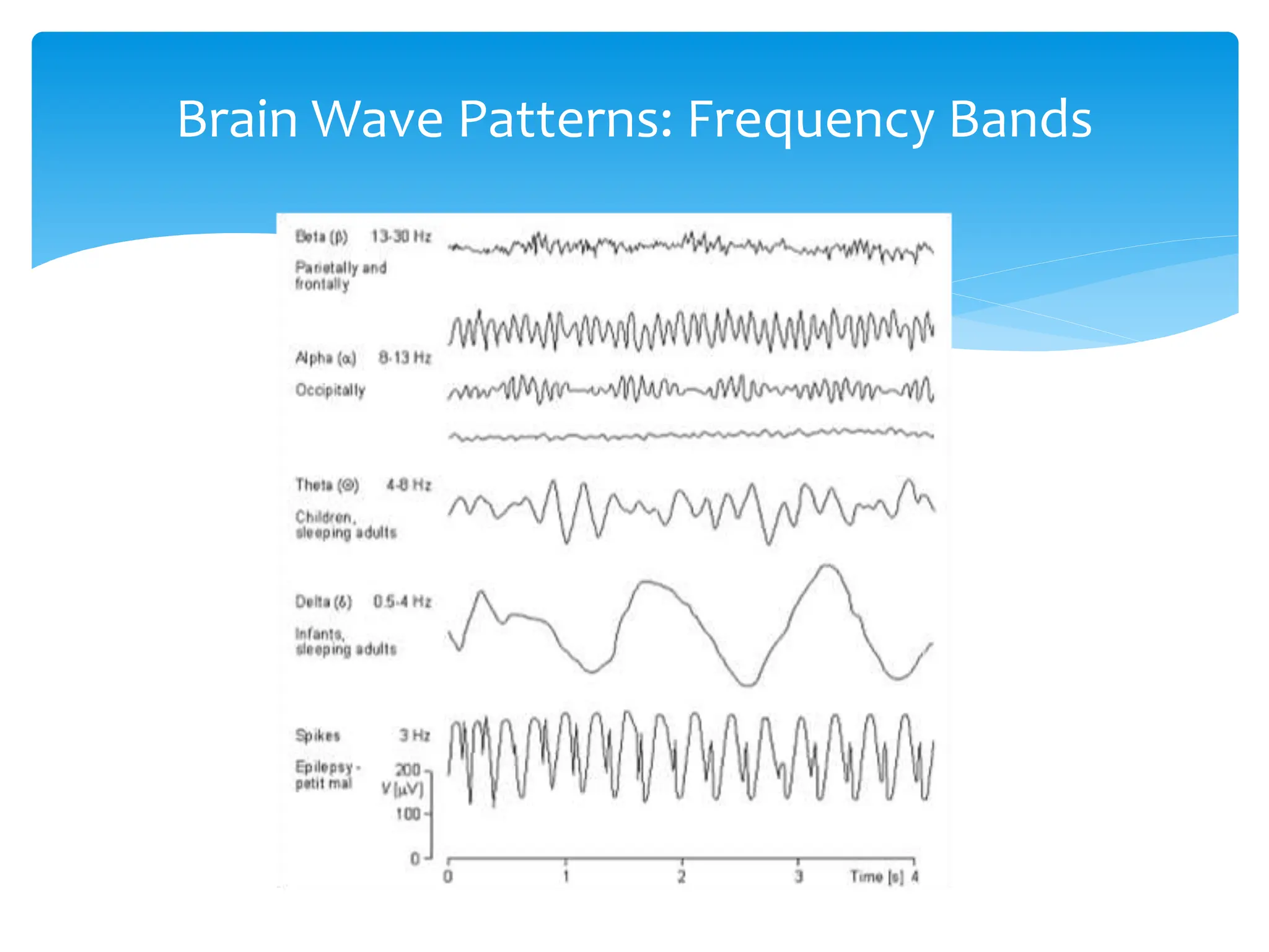 Eeg Signal Processing And Application To Neurofeedback Operant Conditioning Brain And
