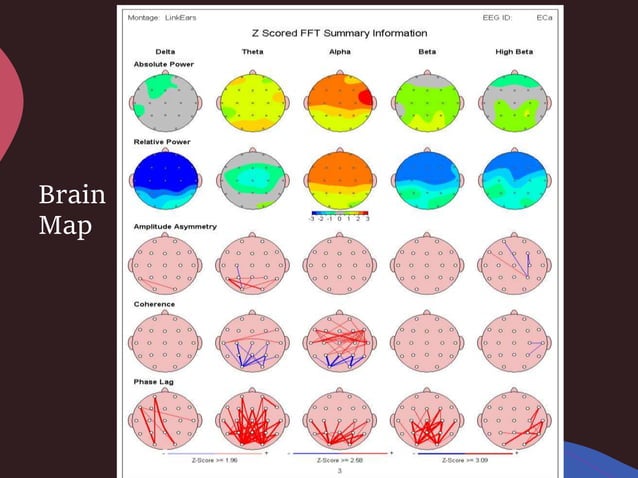 EEG signal processing and application to Neurofeedback : Operant ...
