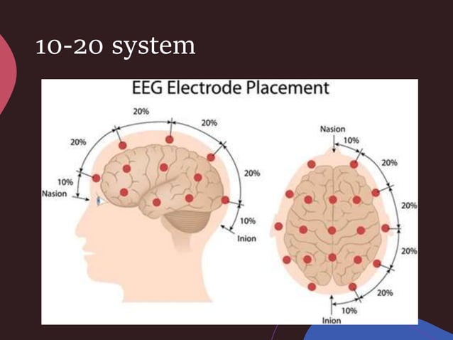 EEG signal processing and application to Neurofeedback : Operant ...