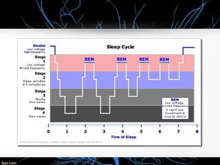 EEG & Sleep | PPTX | Sleep Disorders | Diseases and Conditions