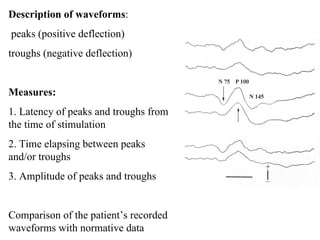 Eeg Sleep Iom Ver | PPT | Sleep Disorders | Diseases and Conditions