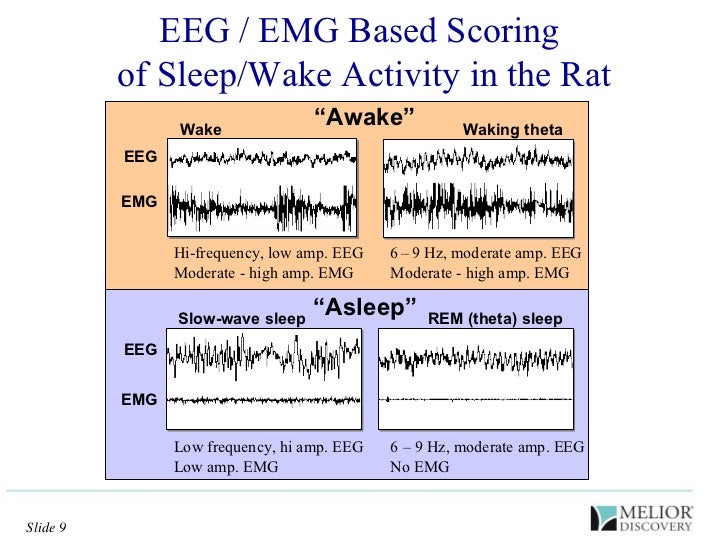 Eeg Sleep Wake Evaluation