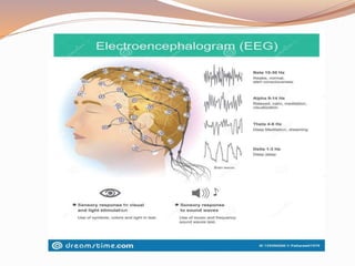 EEG WAVES | PPTX | Sleep Disorders | Diseases and Conditions