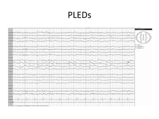 eeg y enfermedad cerebrovascular 2 pc.pptx