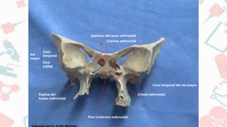 ANATOMIA_HUMANA_del hueso esfenoides.pptx