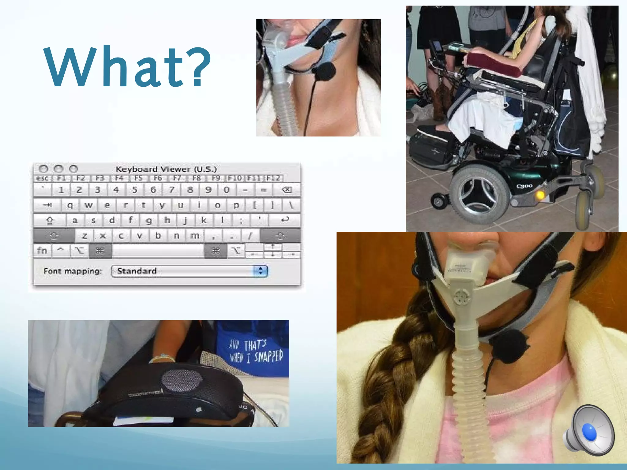 Eex child case study | PPT