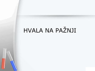 UzelacMonika, diplomski rad | PPT | Free Download