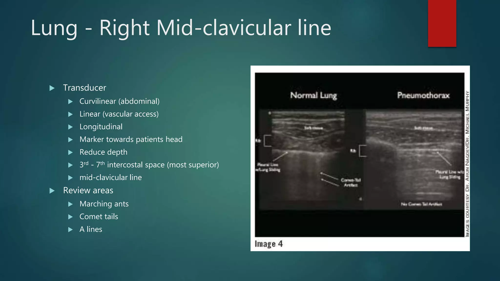 E-Fast Examination | PPTX