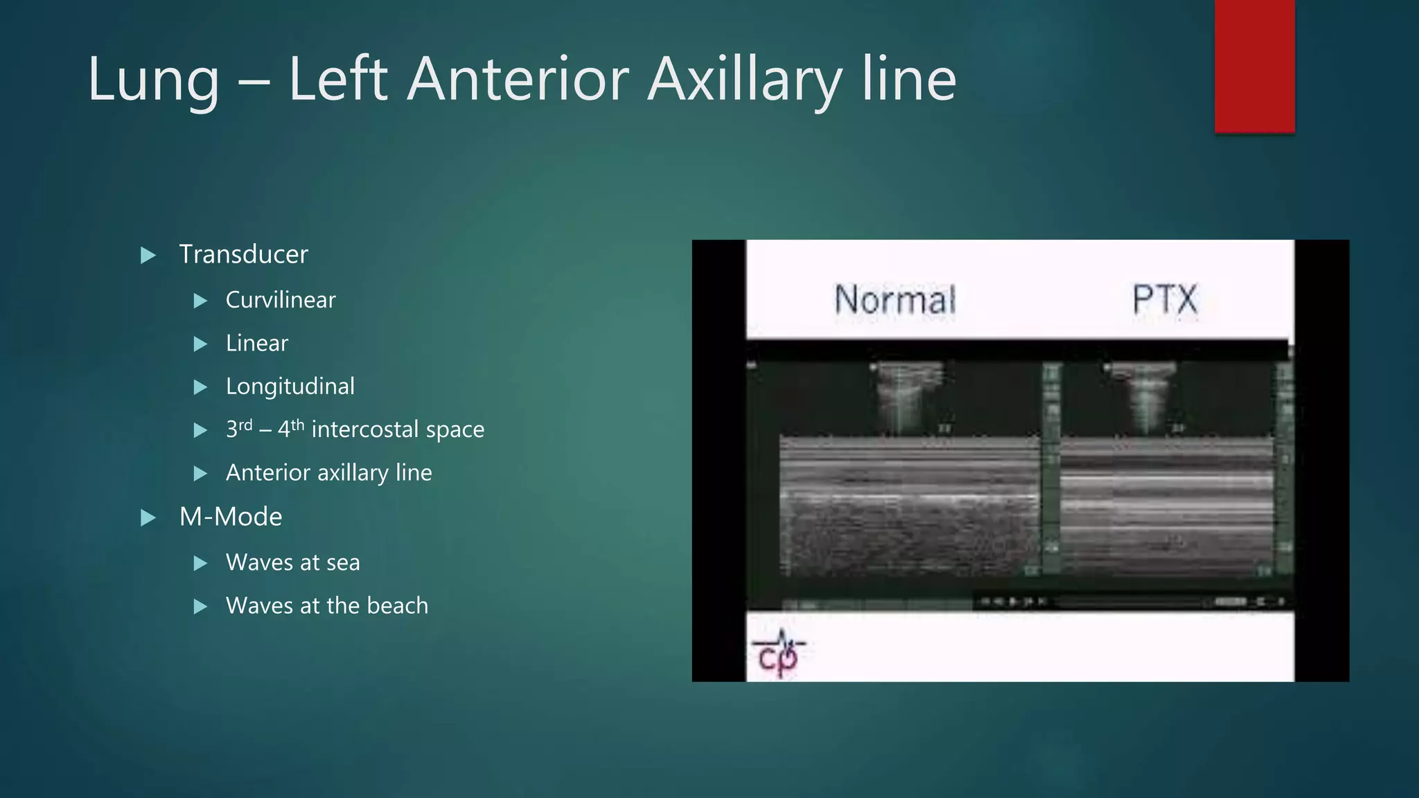 E-Fast Examination | PPTX