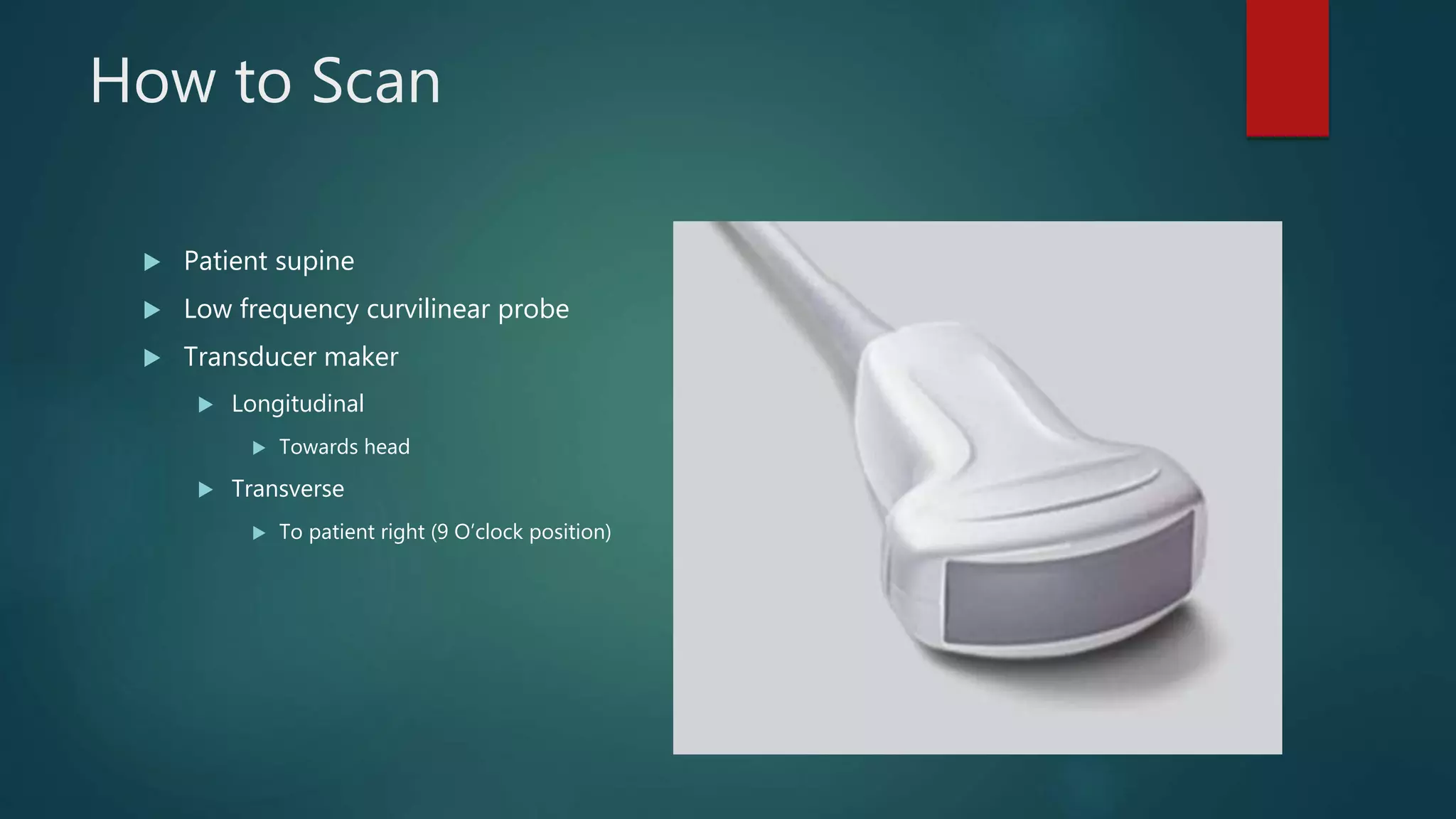 E-Fast Examination | PPTX
