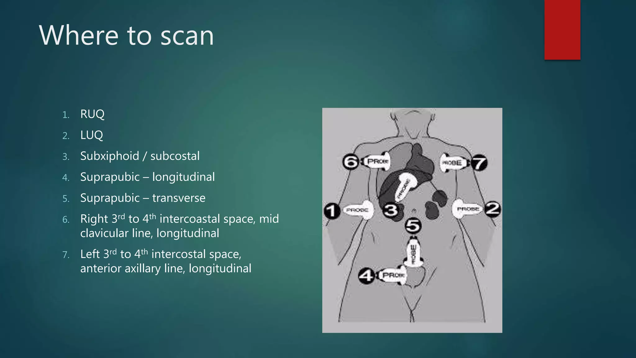 E-Fast Examination | PPTX