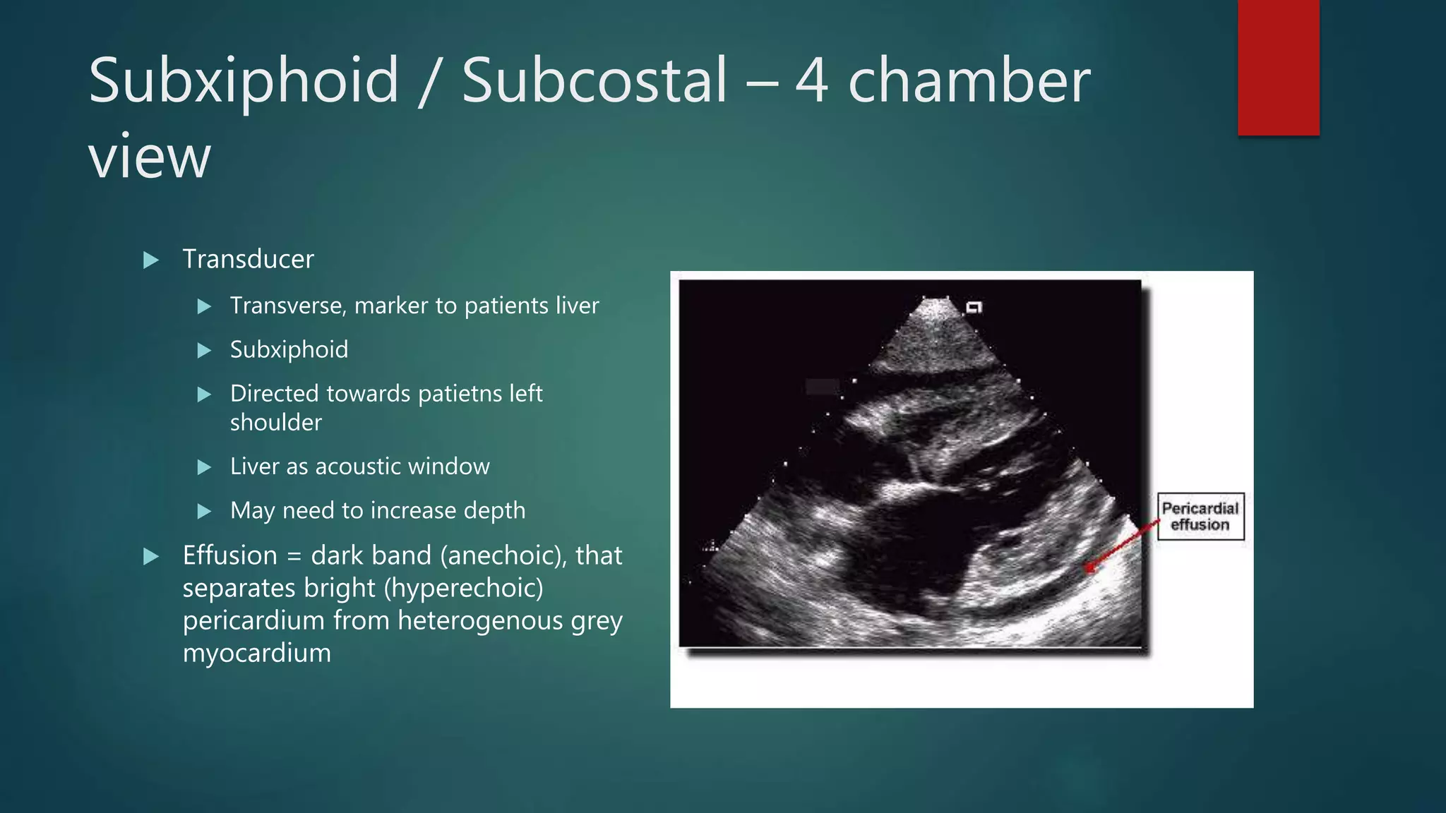 E-Fast Examination | PPTX