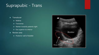 E-Fast Examination | PPTX