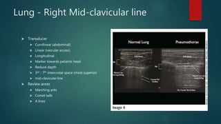 E-Fast Examination | PPTX