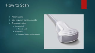 E-Fast Examination | PPTX