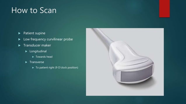 E-Fast Examination | PPTX | Lung and Respiratory Health | Diseases and ...