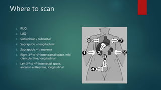 E-Fast Examination | PPTX