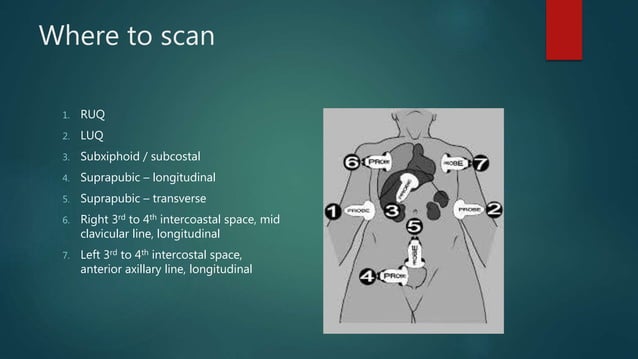 E-Fast Examination | PPTX | Lung and Respiratory Health | Diseases and ...