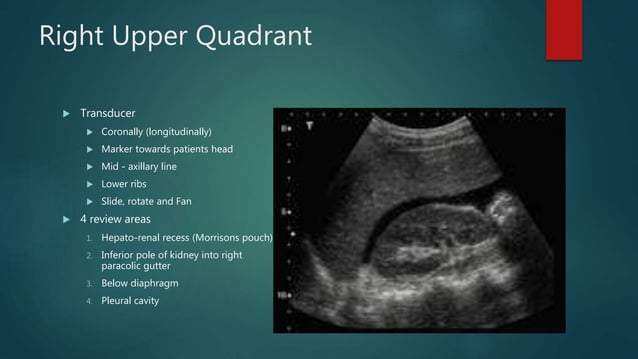 E-Fast Examination | PPTX | Lung and Respiratory Health | Diseases and ...