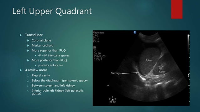 E-Fast Examination | PPTX | Lung and Respiratory Health | Diseases and ...