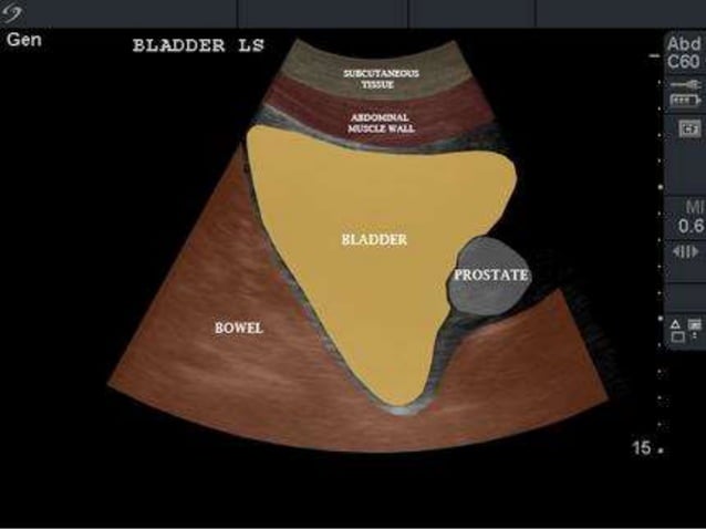 EFAST - A how to guide | PPTX | First Aid | Injuries