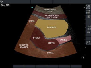 EFAST - A how to guide | PPTX