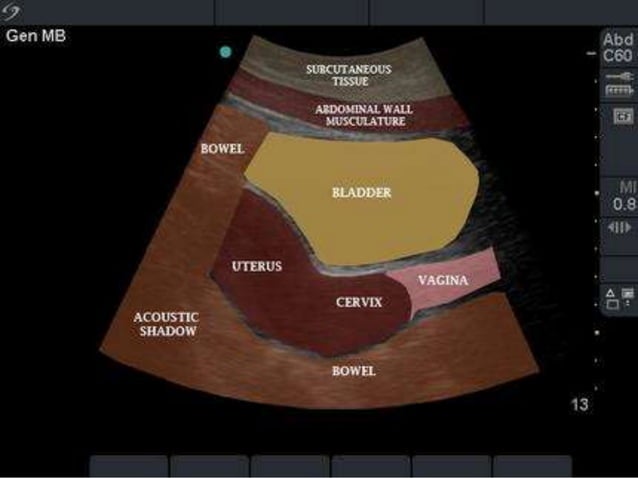 EFAST - A how to guide | PPTX | First Aid | Injuries