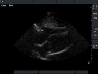 EFAST - A how to guide | PPTX