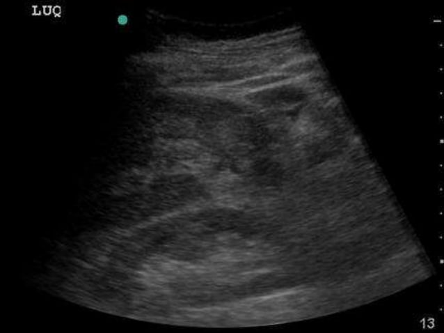 EFAST - A how to guide | PPTX | First Aid | Injuries